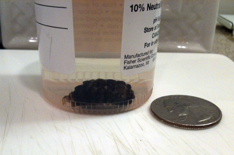 Brain-Eating | Covered in Cat Hair